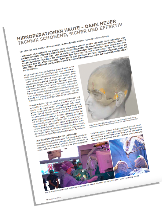 Hydrocephalus & Cysts – Endomin